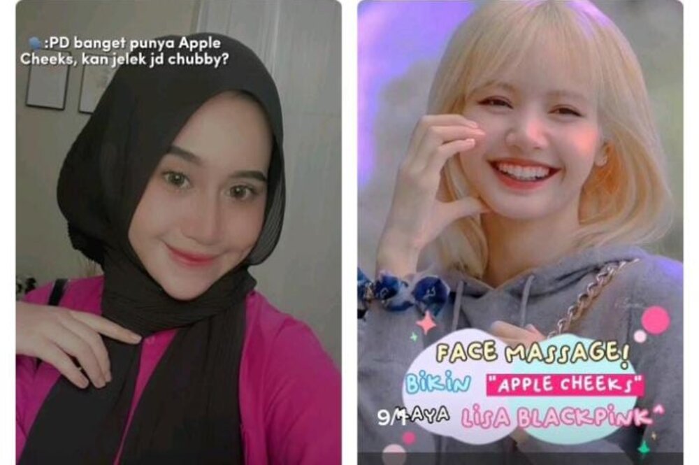 Mengenal Istilah Apple Cheeks yang Lagi Tren
